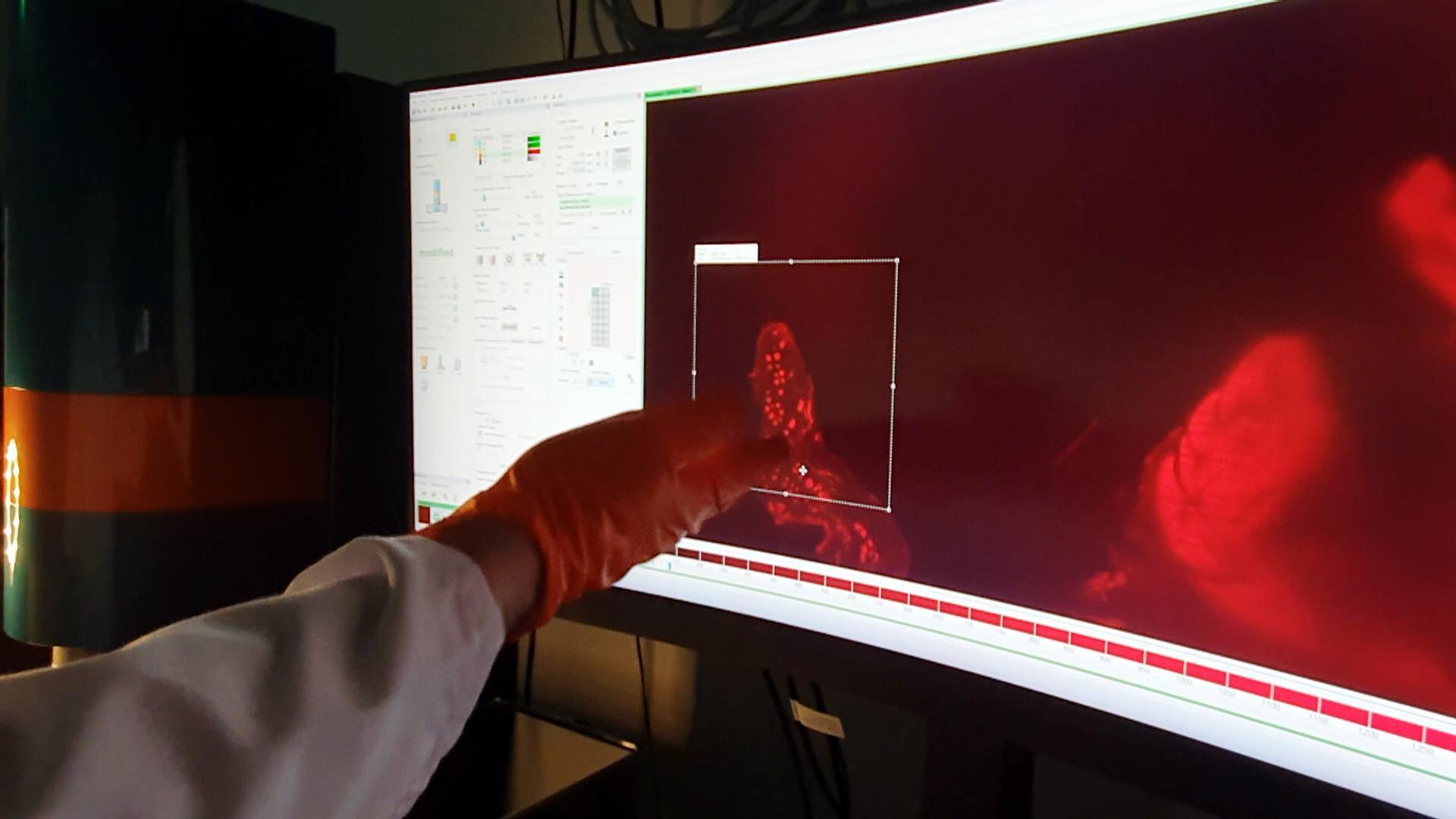 Turkish signature in studies that will make world medical history ...